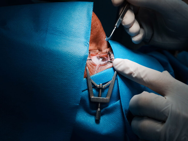 Refractive Surgery Consultation & Assessment – Killarney Optometric Centre